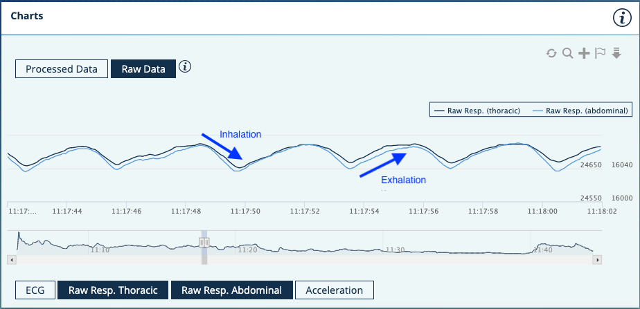 How do the Hexoskin RIP sensors work?