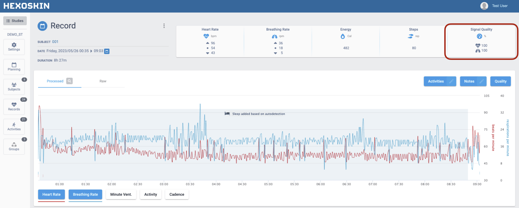 How to monitor signal quality (OneView Dashboard)