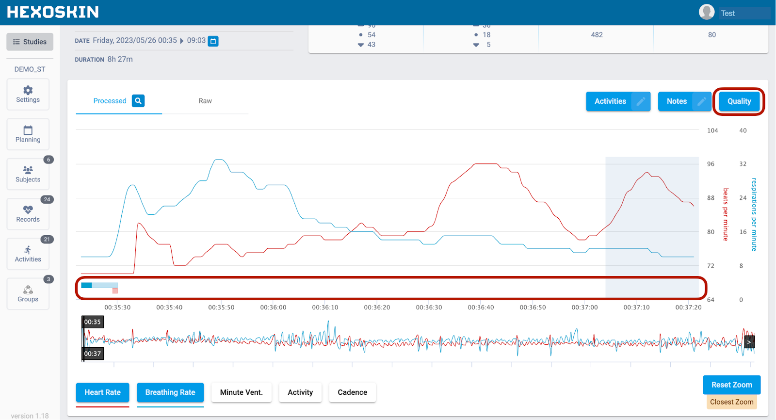 How to monitor signal quality (OneView Dashboard)